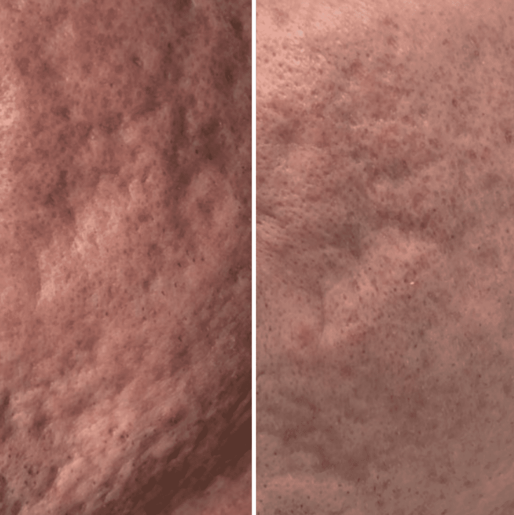 Plasma Lift - Glow Aesthetic