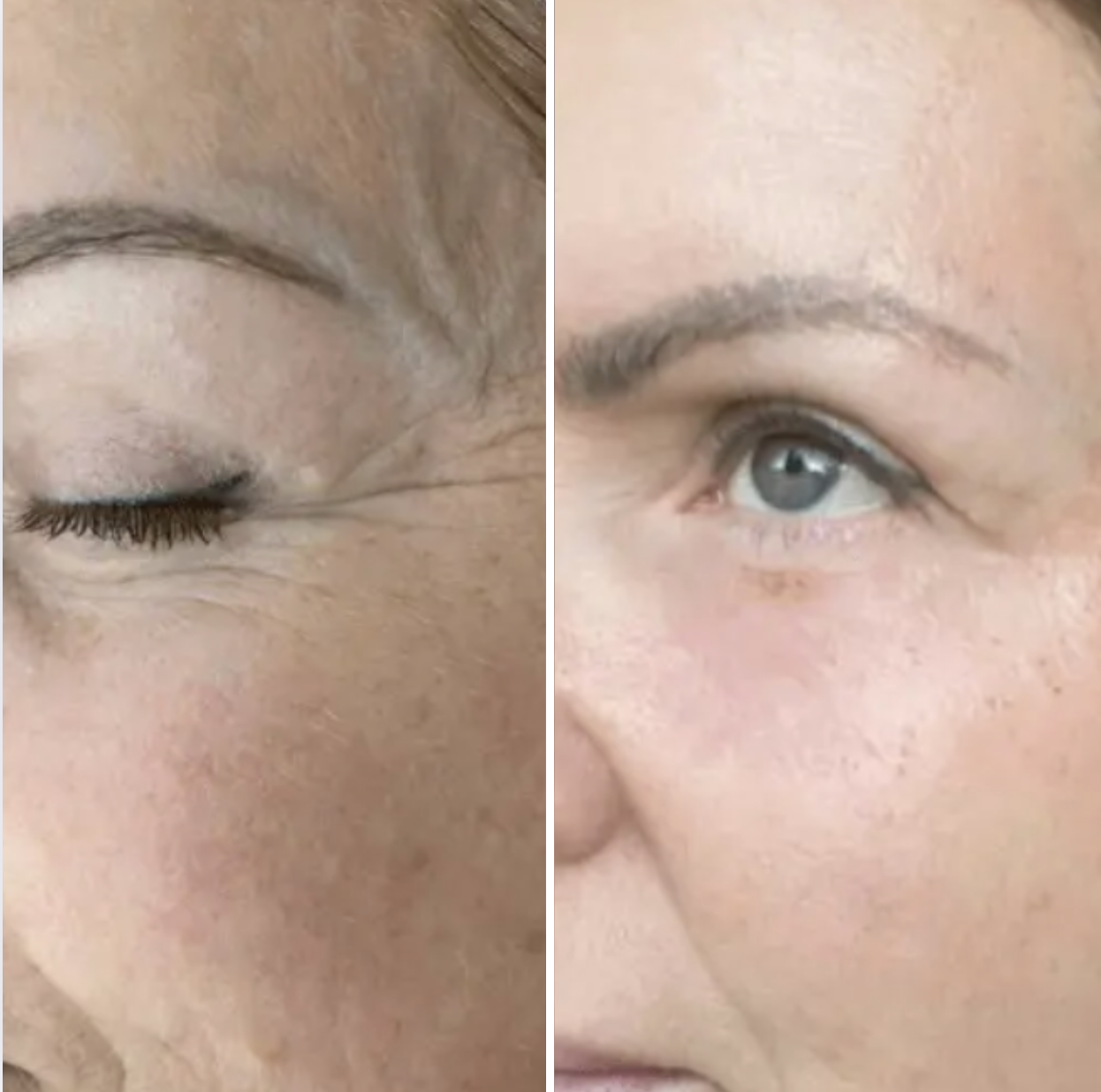 Plasma Lift - Glow Aesthetic