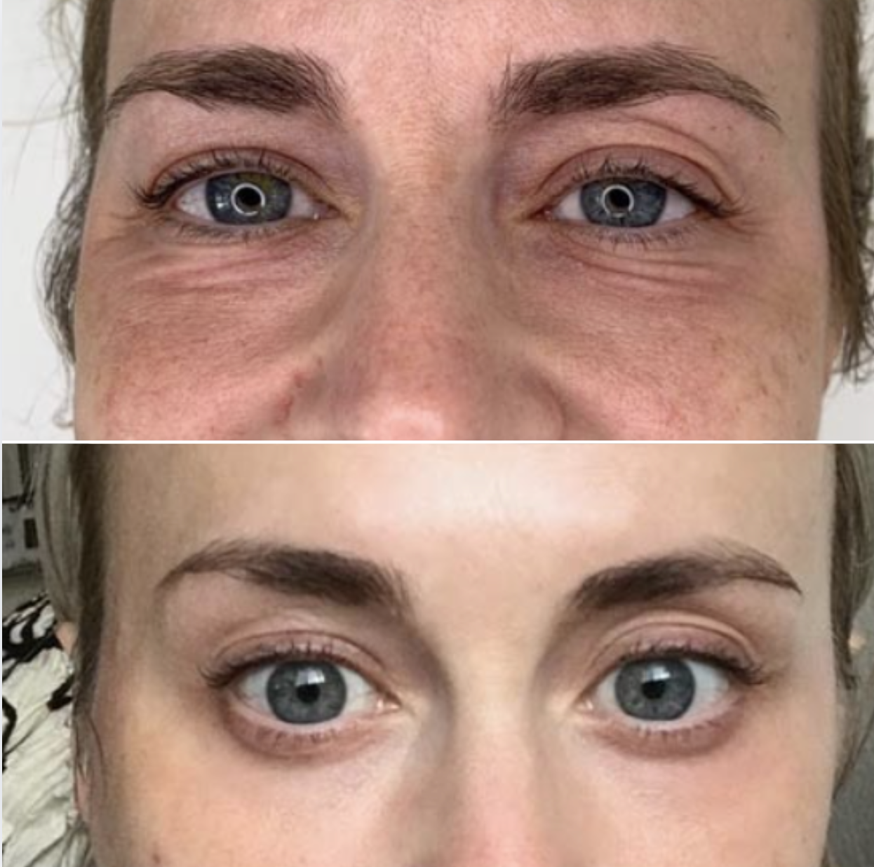 Plasma Lift - Glow Aesthetic