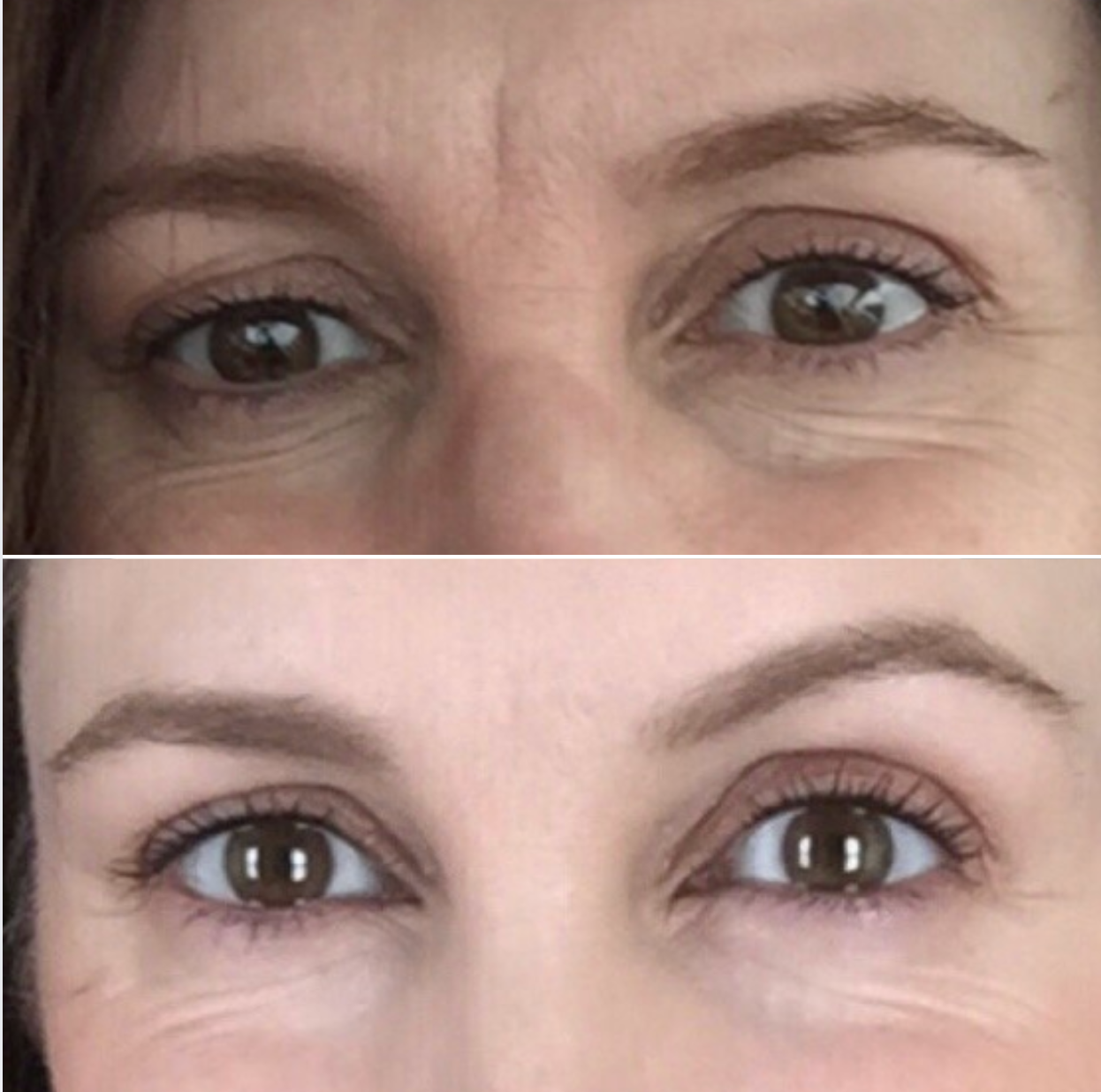 Plasma Lift - Glow Aesthetic